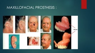 Introduction to Prosthodontics.ppt dentistryx | PPTX