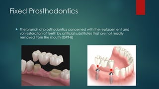 Introduction to Prosthodontics.ppt dentistryx | PPTX