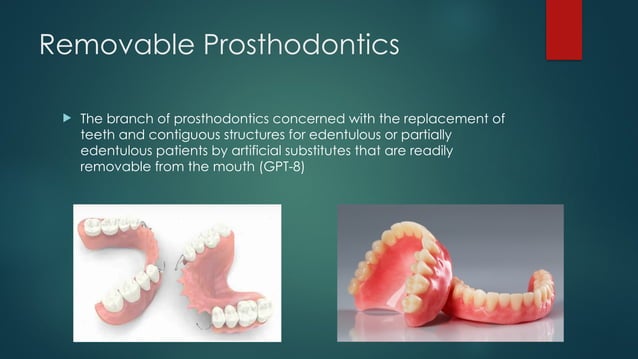 Introduction to Prosthodontics.ppt dentistryx | PPTX