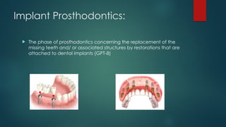 Introduction to Prosthodontics.ppt dentistryx | PPTX