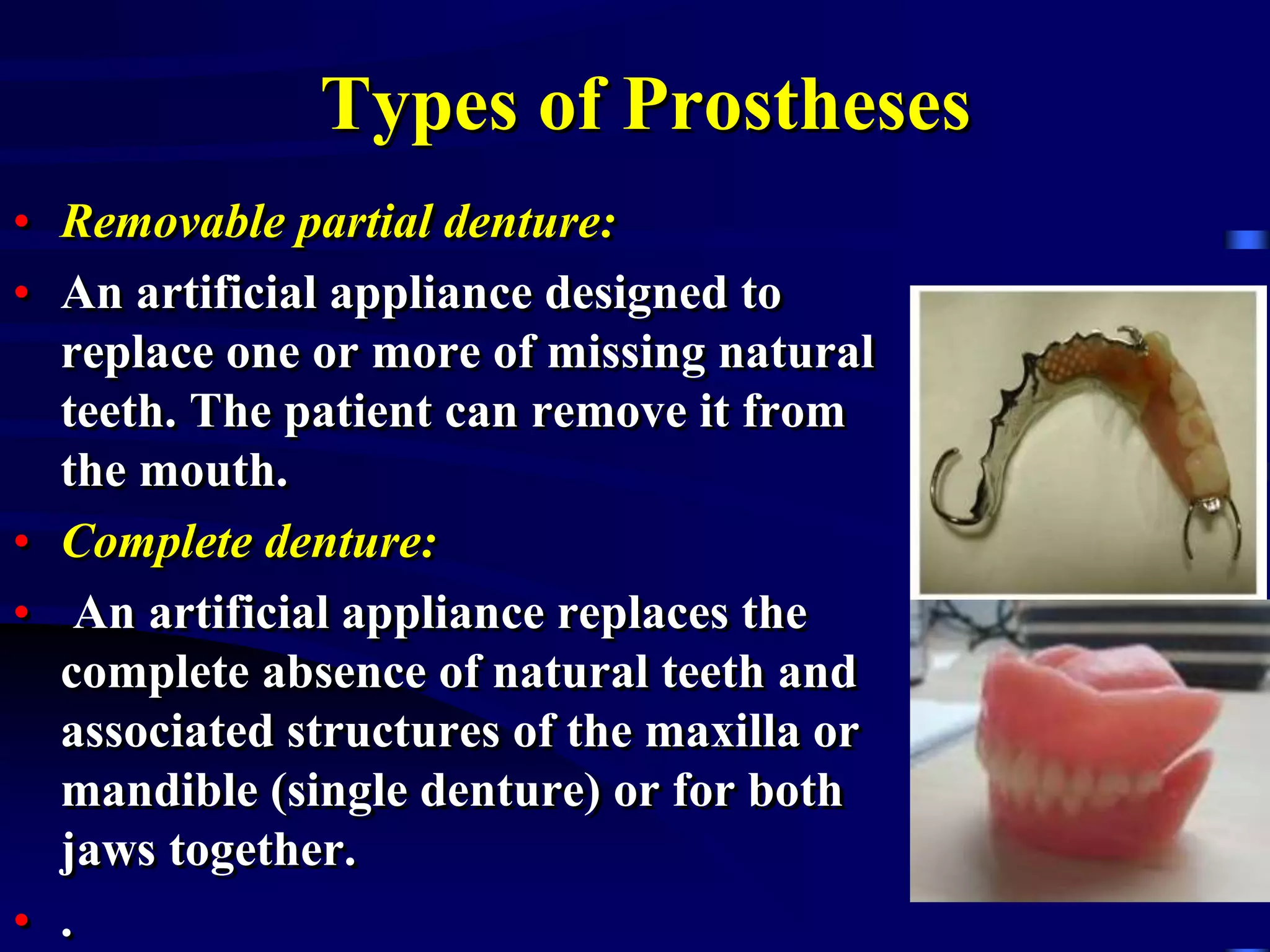 Introduction to Prosthodontics CD .ppt