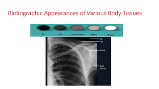 Introduction to radiology | PPTX