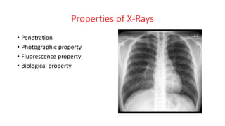 Introduction to radiology | PPTX