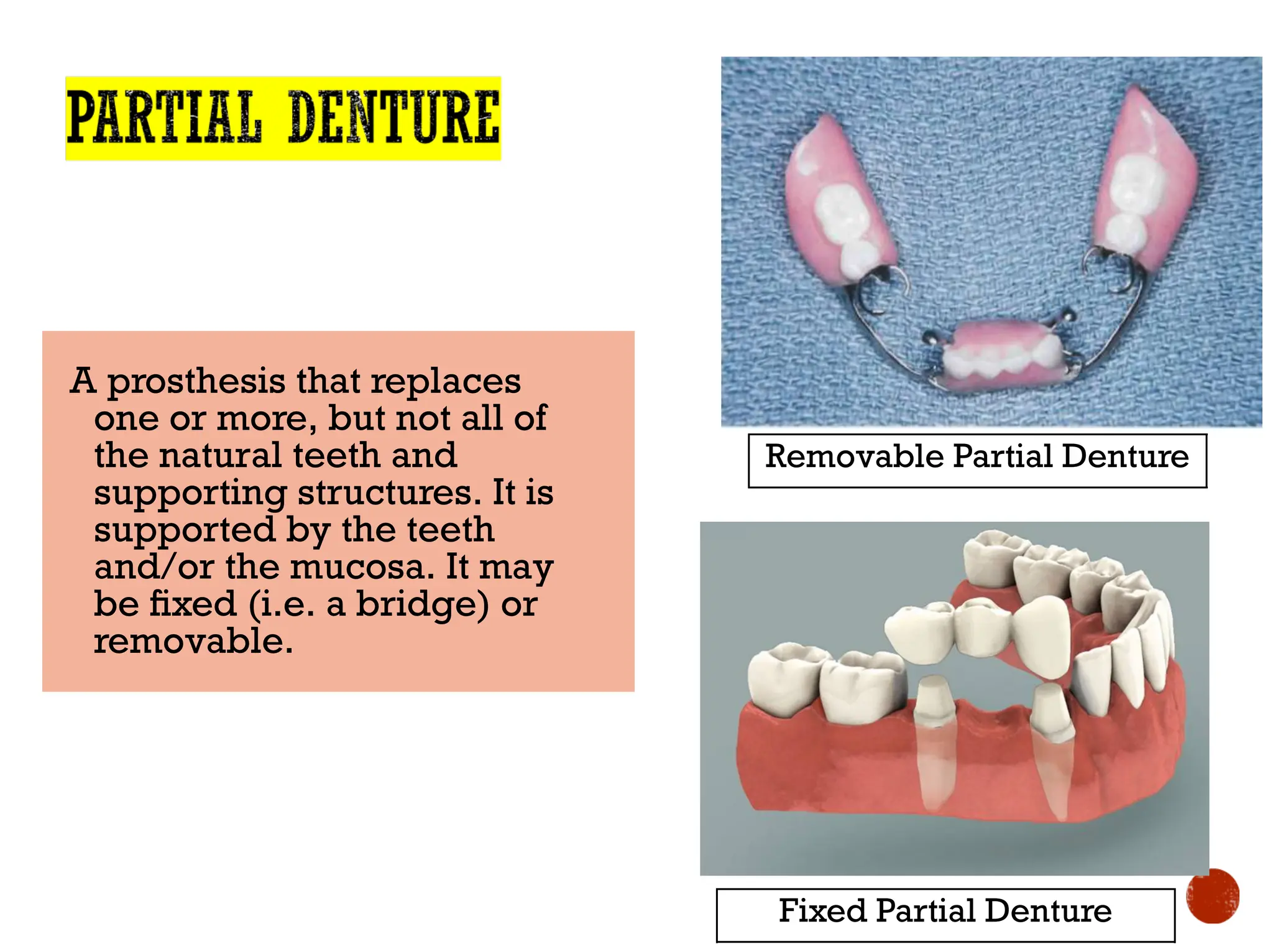 introduction_to_removable_partial_prosthodontics (lec 1) (1).pdf