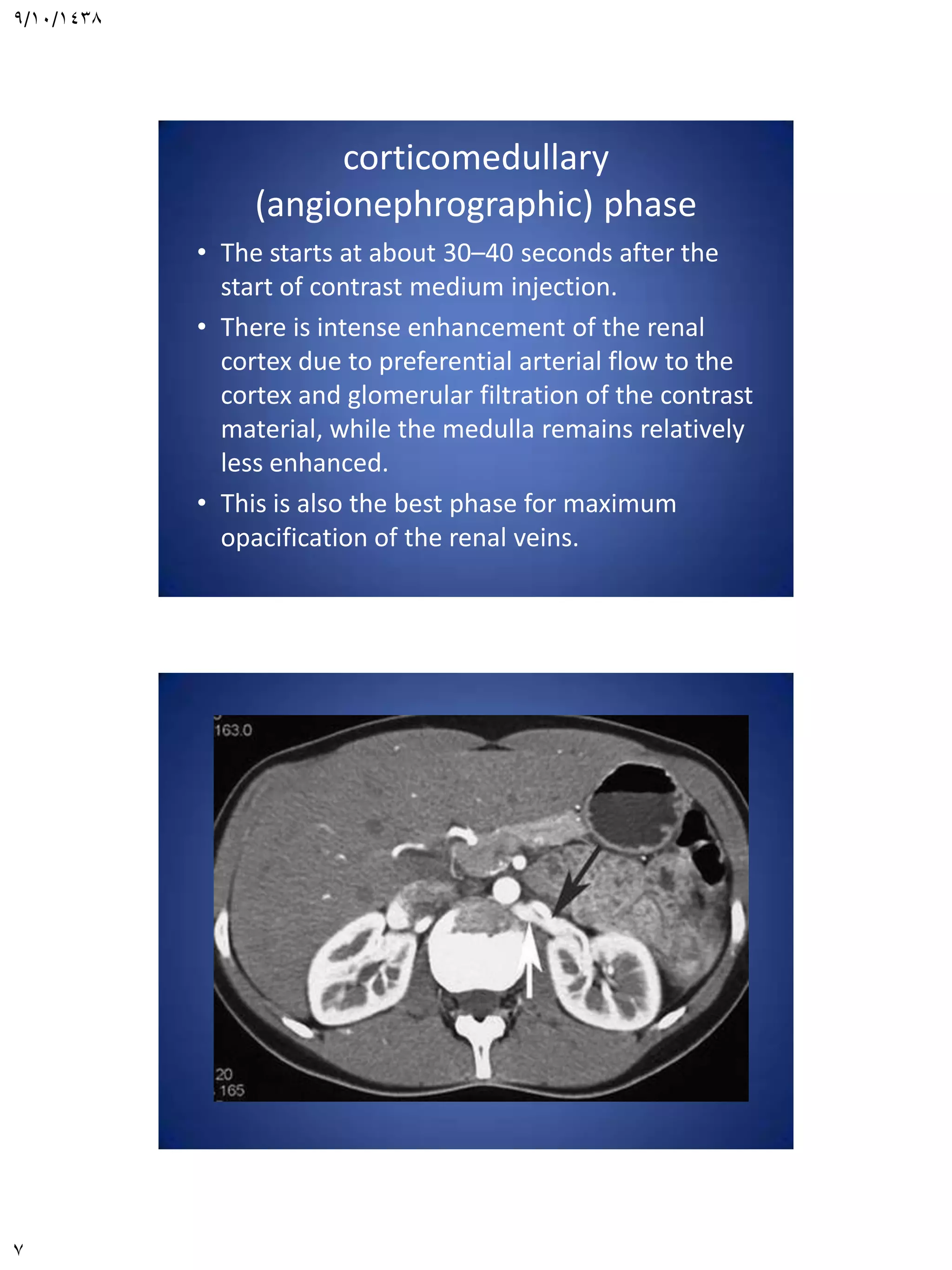 Introduction to renal ct scan | PDF