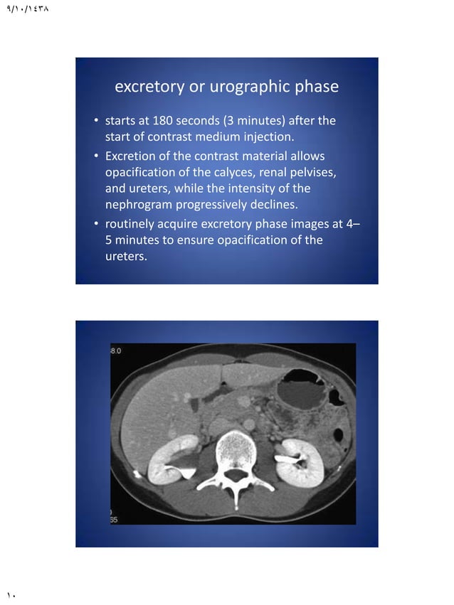 Introduction to renal ct scan | PDF