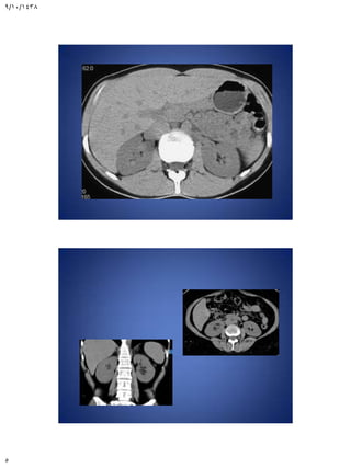 Introduction to renal ct scan | PDF