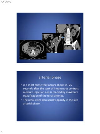 Introduction to renal ct scan | PDF