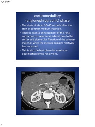 Introduction to renal ct scan | PDF