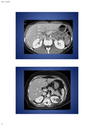 Introduction to renal ct scan | PDF