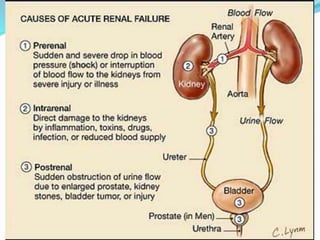 Introduction to renal failure and dialysis | PPTX