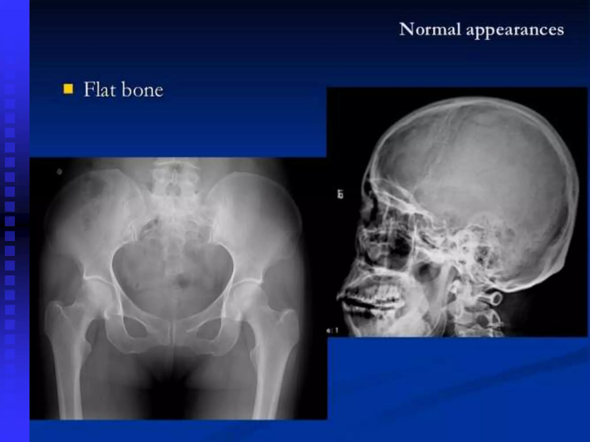 Introduction to skeletal imaging | PPTX
