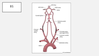 Introduction to stroke asem | PPTX