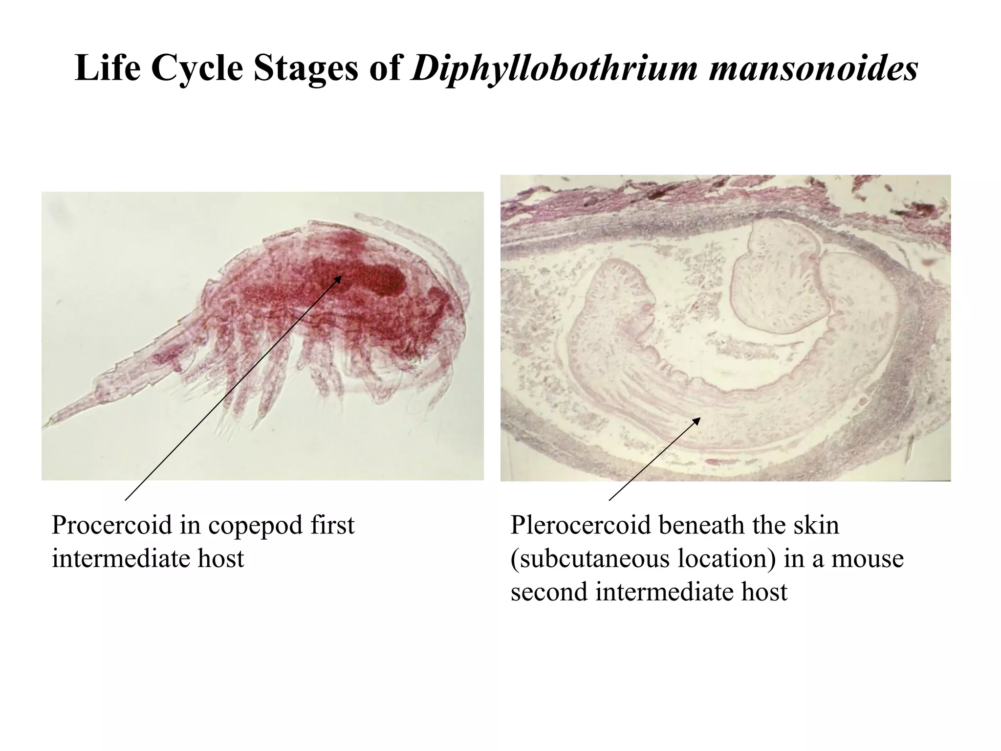 Introduction To Tapeworms | PPT