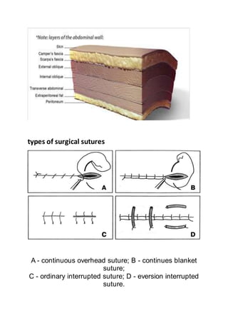 Introduction to the topographical anatomy and operative sugery | DOCX