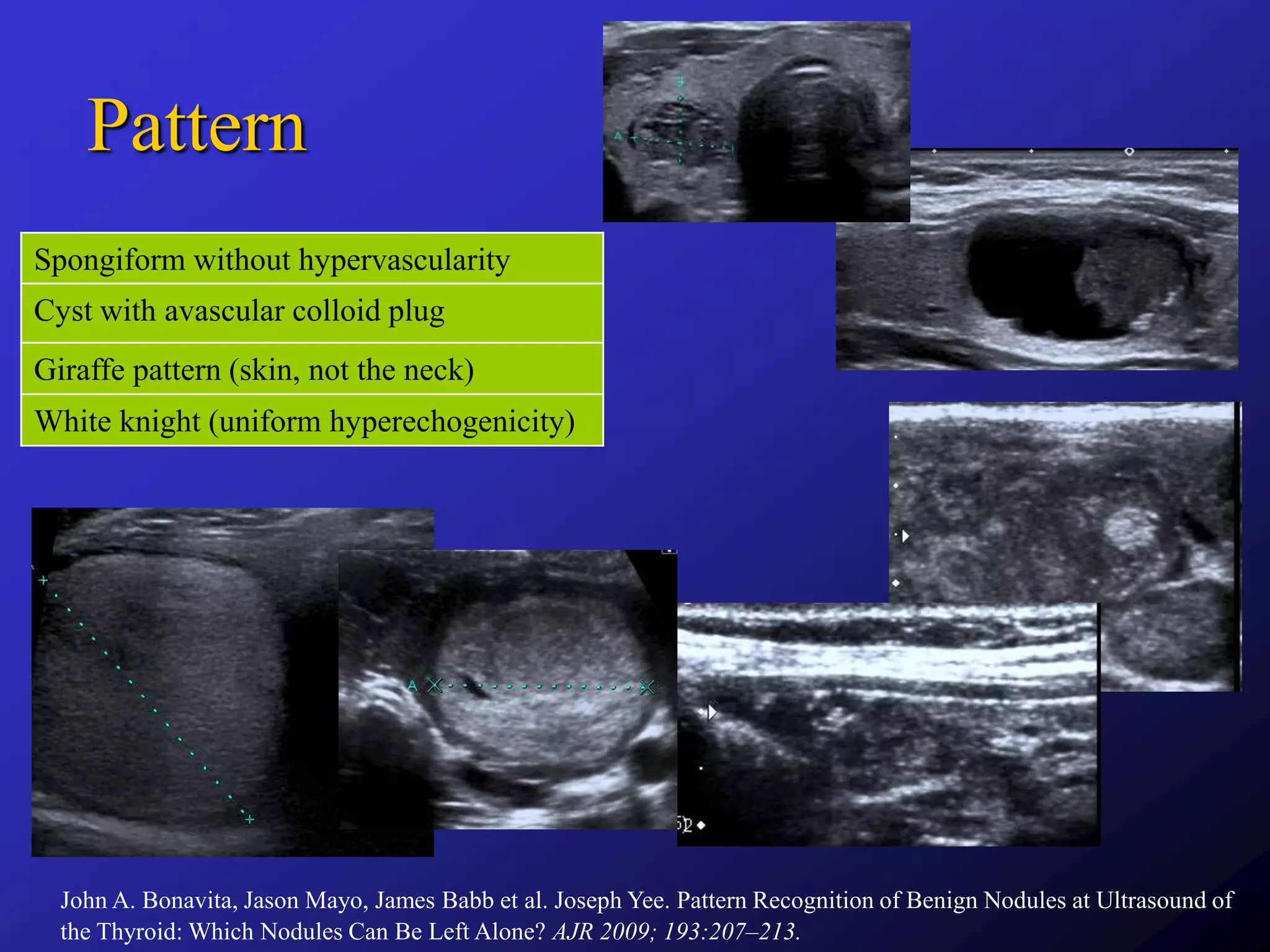 Introduction to thryoid ultrasound | PPTX