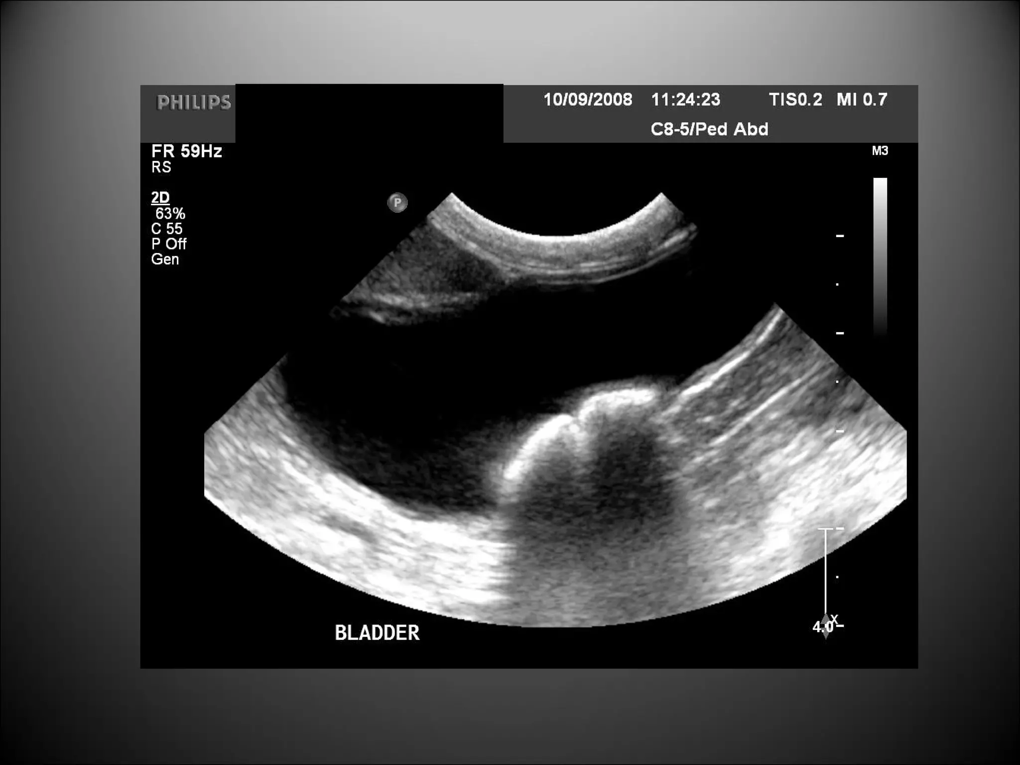 Introduction to ultrasound | PPT
