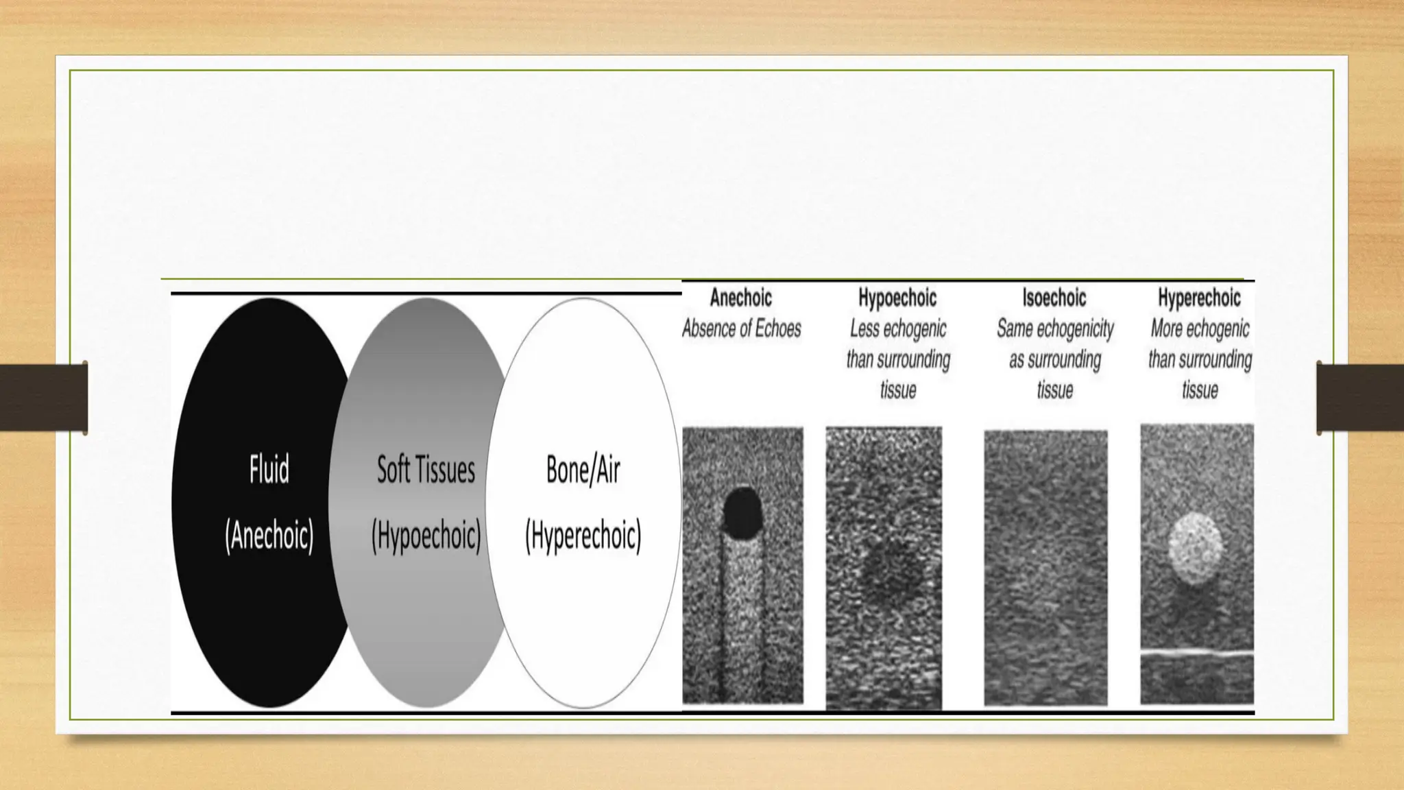 INTRODUCTION TO ULTRASOUND SCAN newww.pptx
