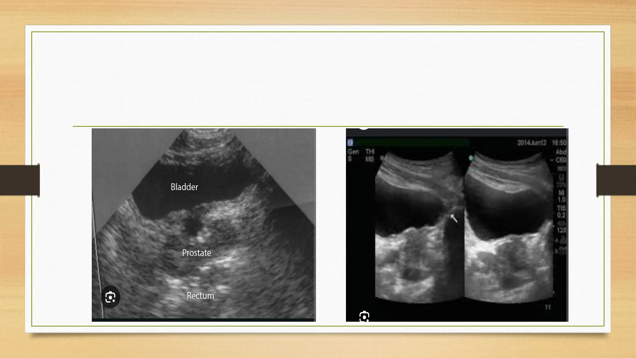 INTRODUCTION TO ULTRASOUND SCAN newww.pptx