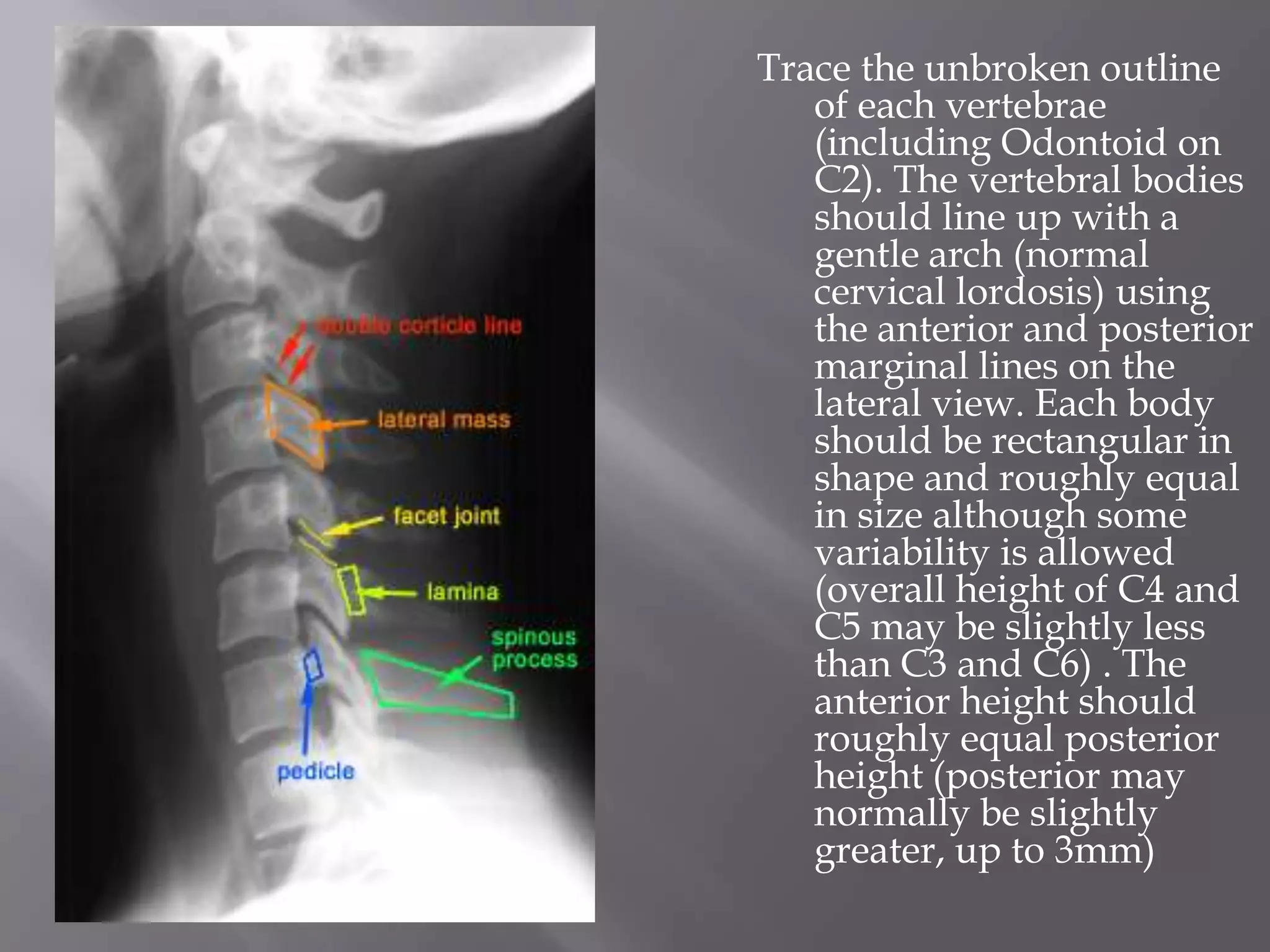 Introduction to musculoskeletal radiology | PPTX