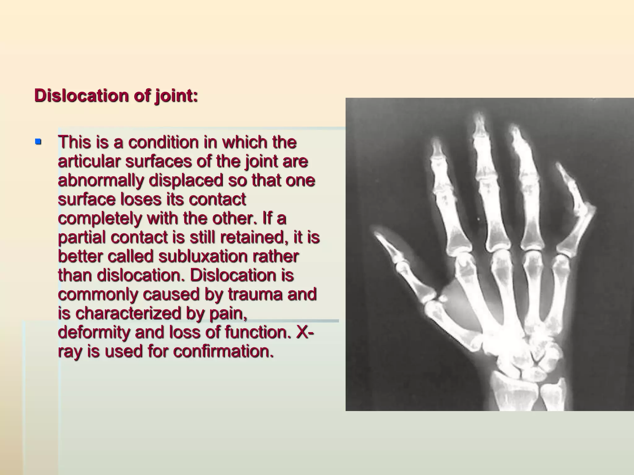 Introductory lecture. osteology (general data). the human skeleton, its ...