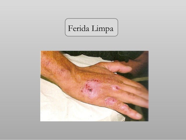 Tratamento de feridas - Aula 01