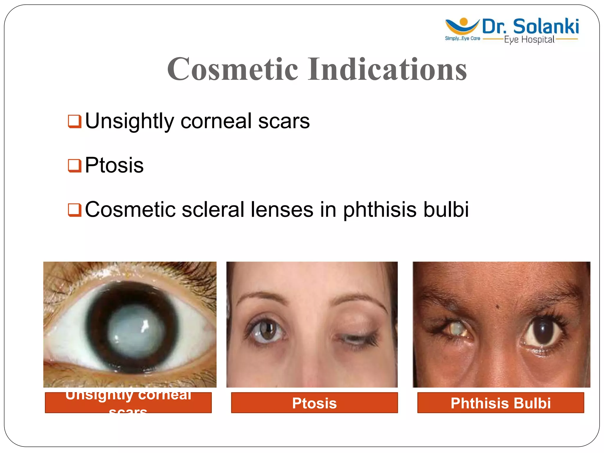 Introduction of contact lens | PPTX