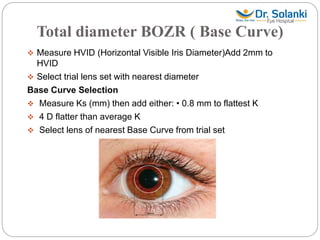 Introduction of contact lens | PPTX