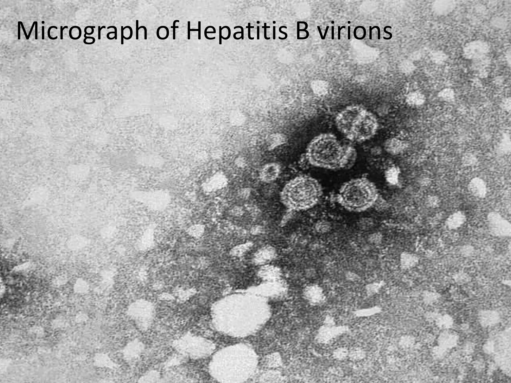 Hepatitis B virus - HBV - Introduction | PPT