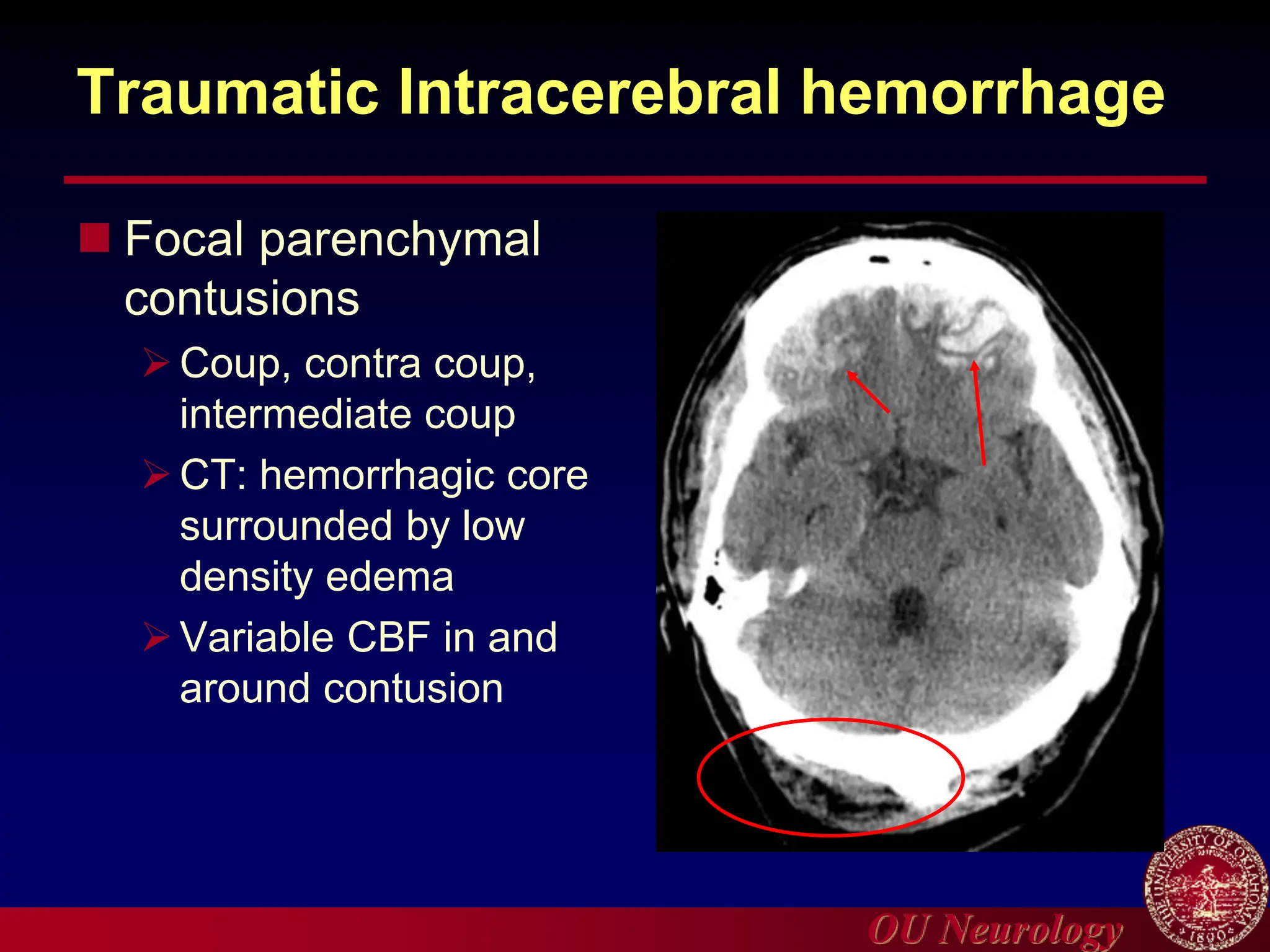 Intro Head CT.ppt
