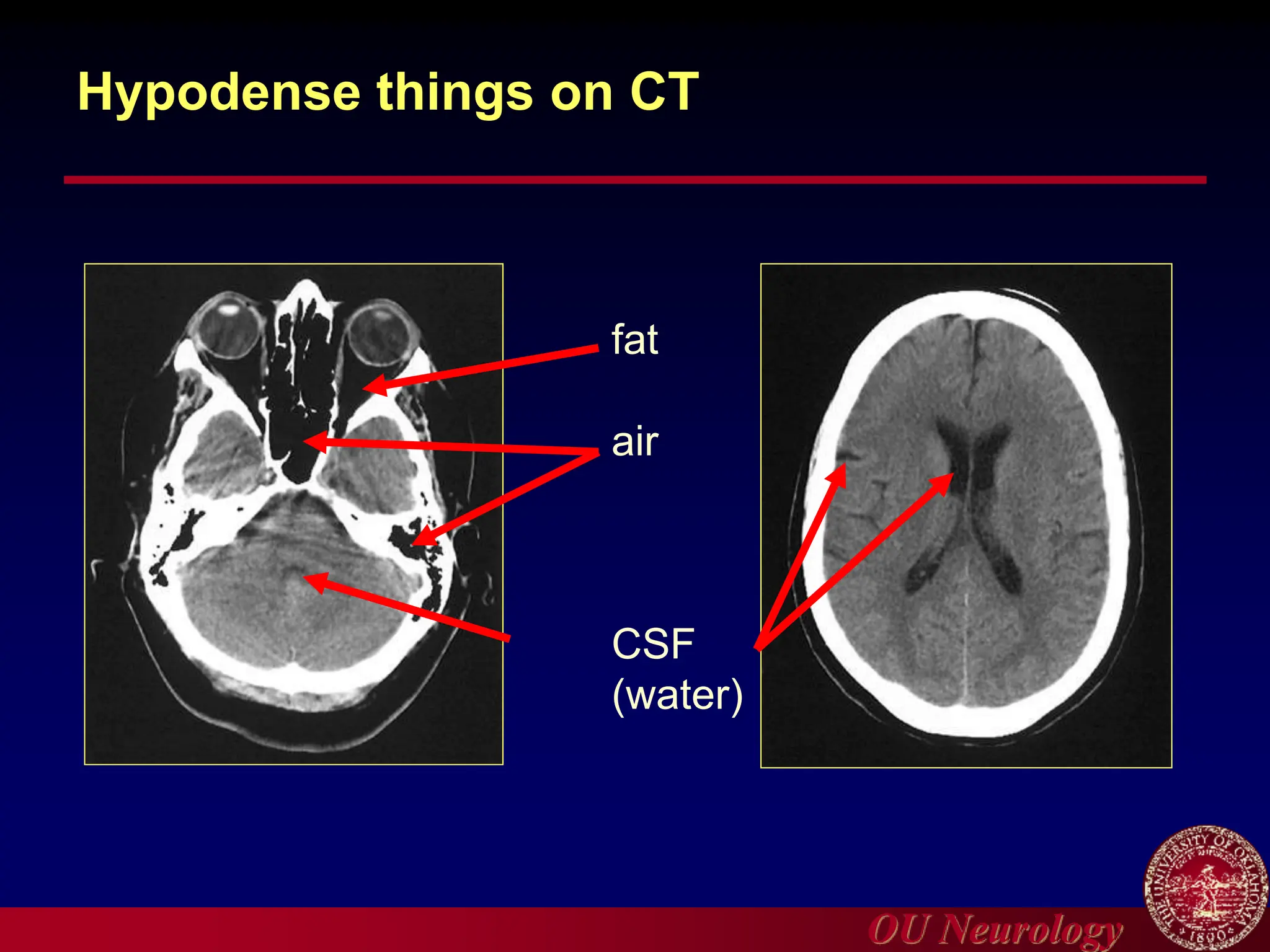 Intro Head CT.ppt