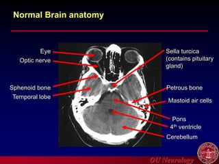 Intro Head CT.ppt | Death, Injury, or Military Conflict | Sensitive Topics