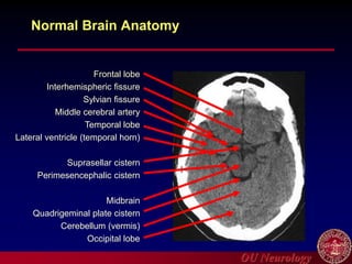 Intro Head CT.ppt