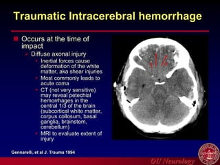 Intro Head CT.ppt | Death, Injury, or Military Conflict | Sensitive Topics