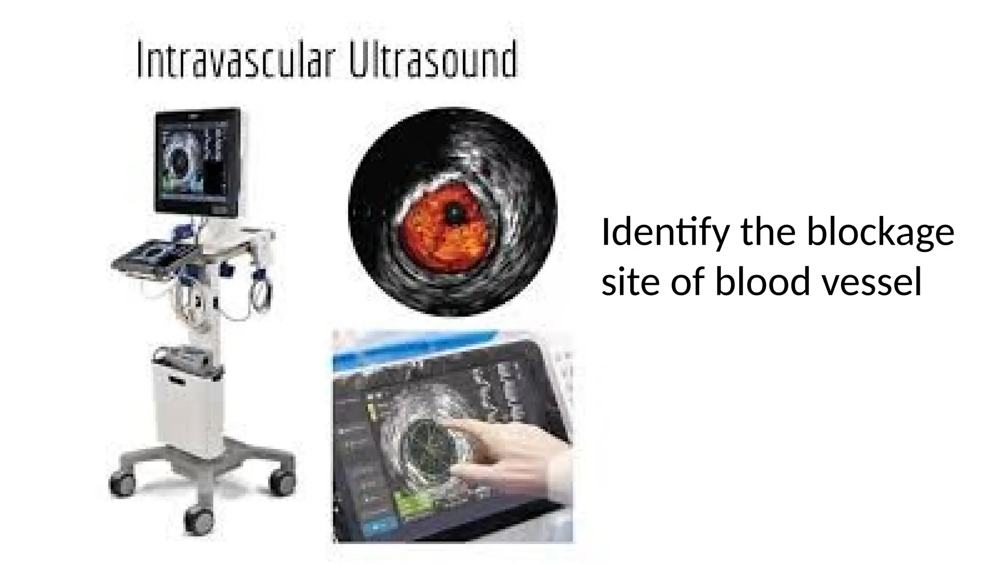 introduction to interventional cardiology.pptx