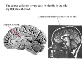 Intro neurology | PPT