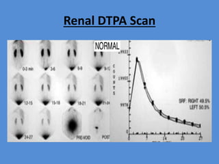 Introduction to Nuclear Medicine | PPTX