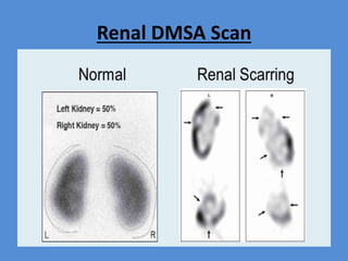 Introduction to Nuclear Medicine | PPTX
