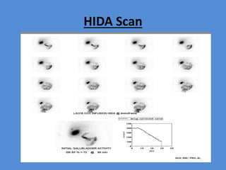 Introduction to Nuclear Medicine | PPTX