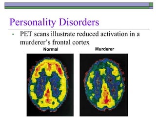 Intro Psychological Disorders.ppt