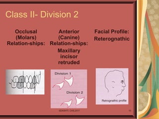 Intro three occlusion | PPT