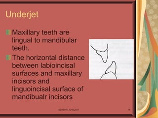 Intro three occlusion | PPT