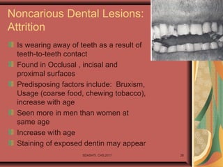 Intro three occlusion | PPT