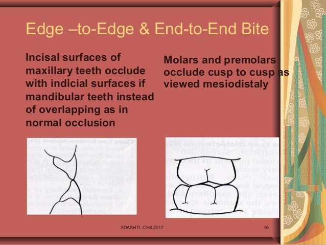 Intro three occlusion