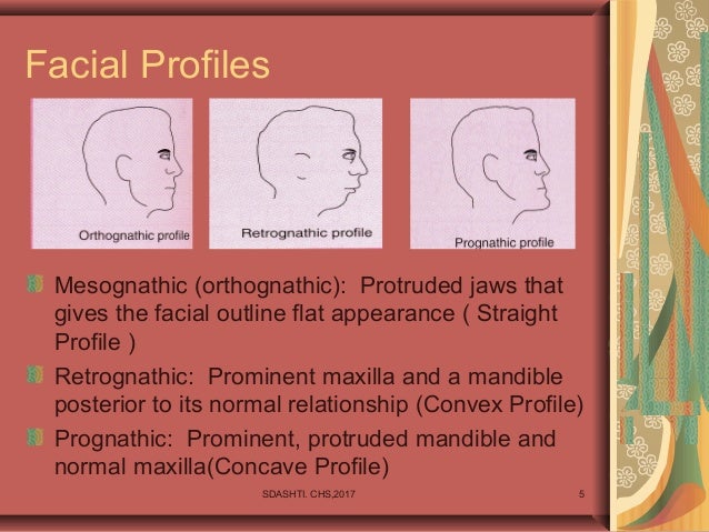 Intro three occlusion
