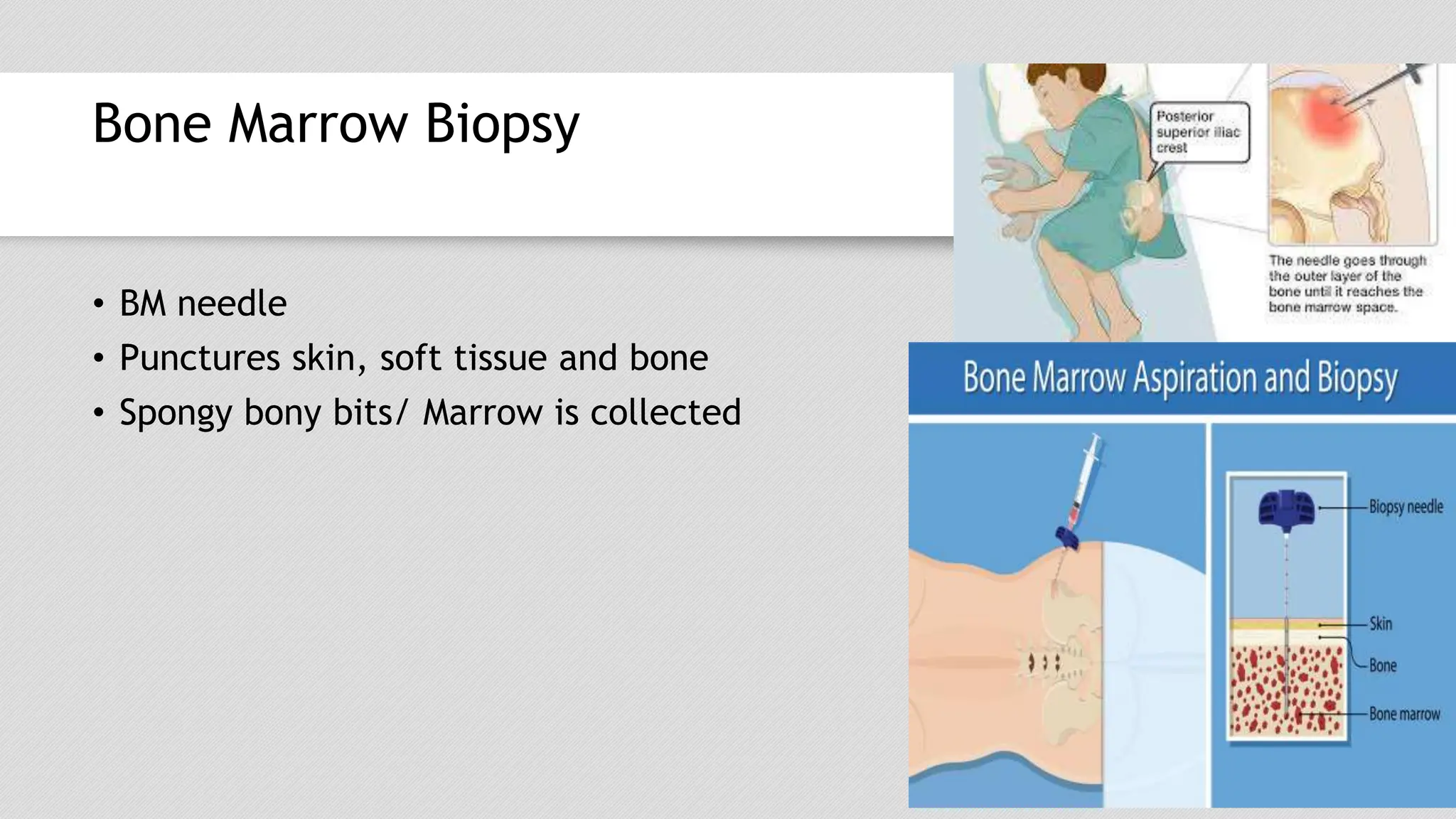 Intro to Biopsy Techniques WK 2 TH.pptx