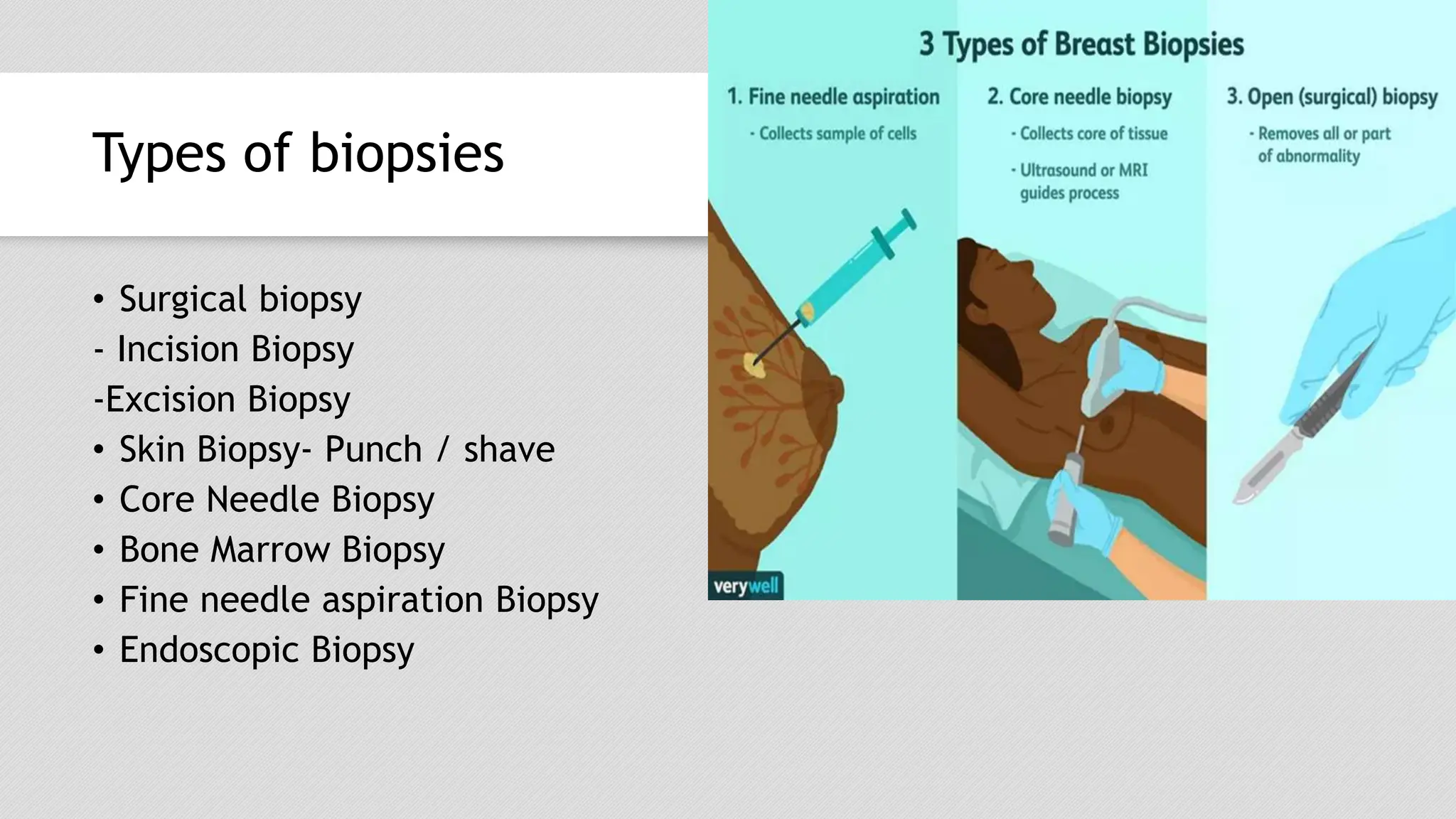 Intro to Biopsy Techniques WK 2 TH.pptx