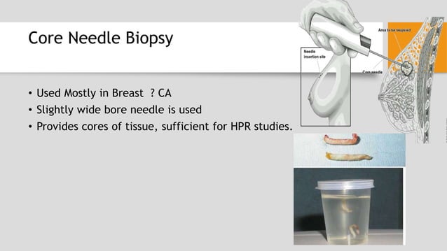 Intro to Biopsy Techniques WK 2 TH.pptx