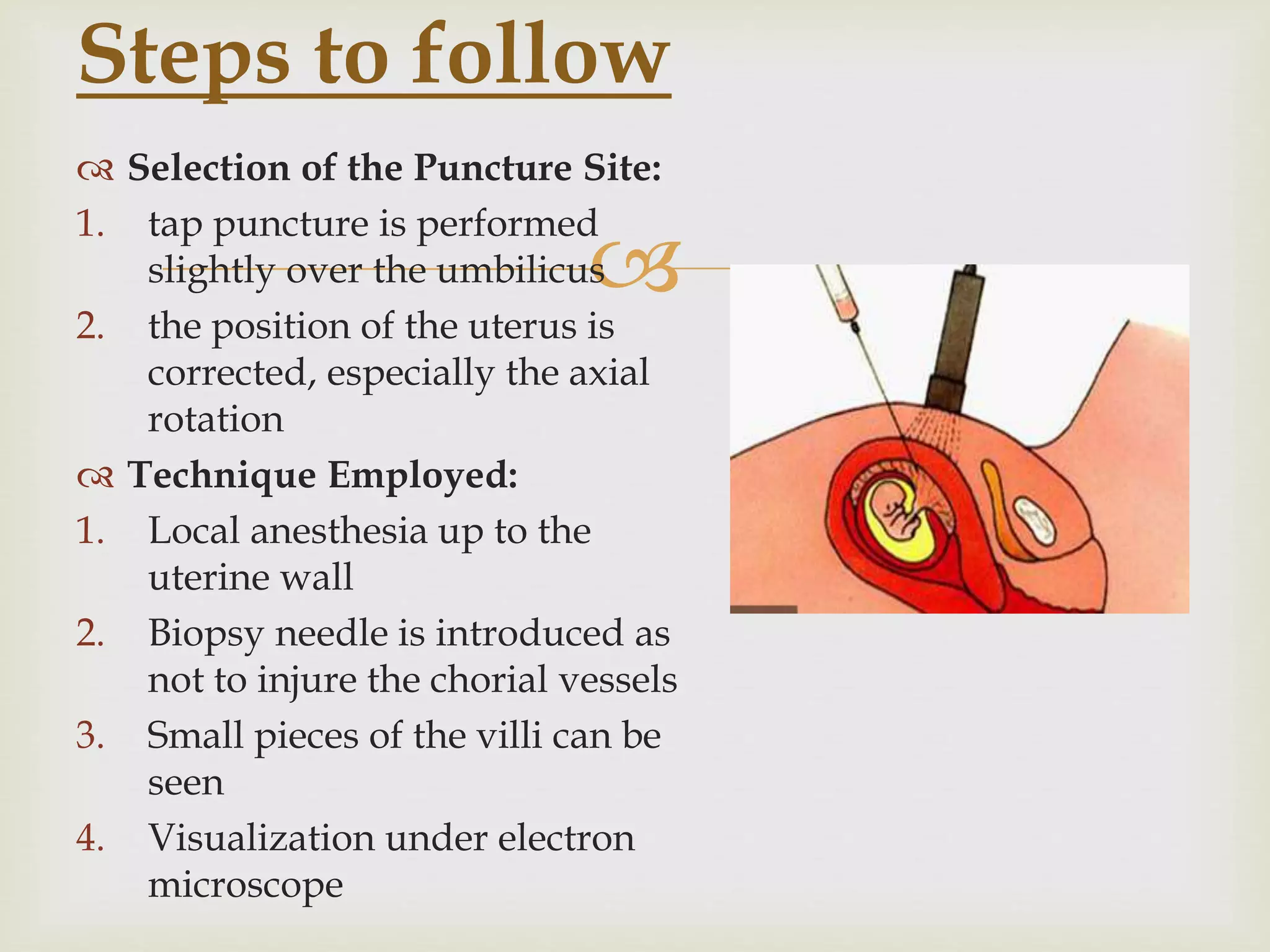 prenatal Diagnosis of genetic Disorders | PPT