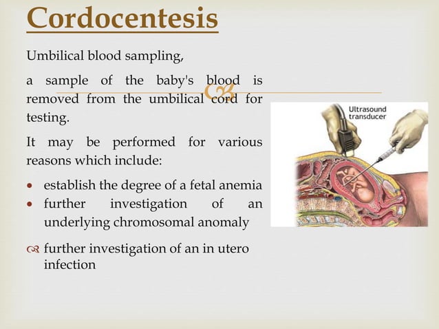 prenatal Diagnosis of genetic Disorders | PPT